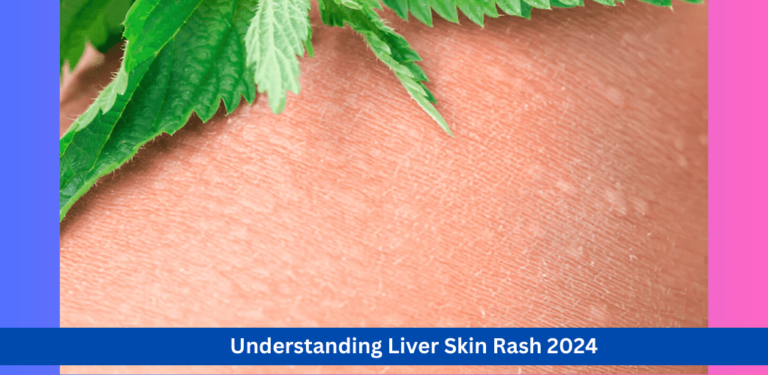 Understanding Liver Skin Rash 2024 - What About CBD
